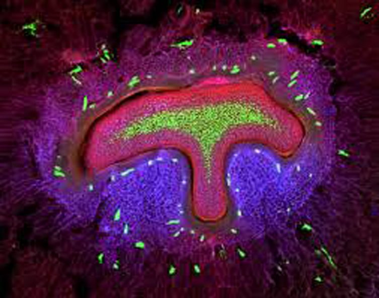 Pycnandra acuminata – Bernadete Alves